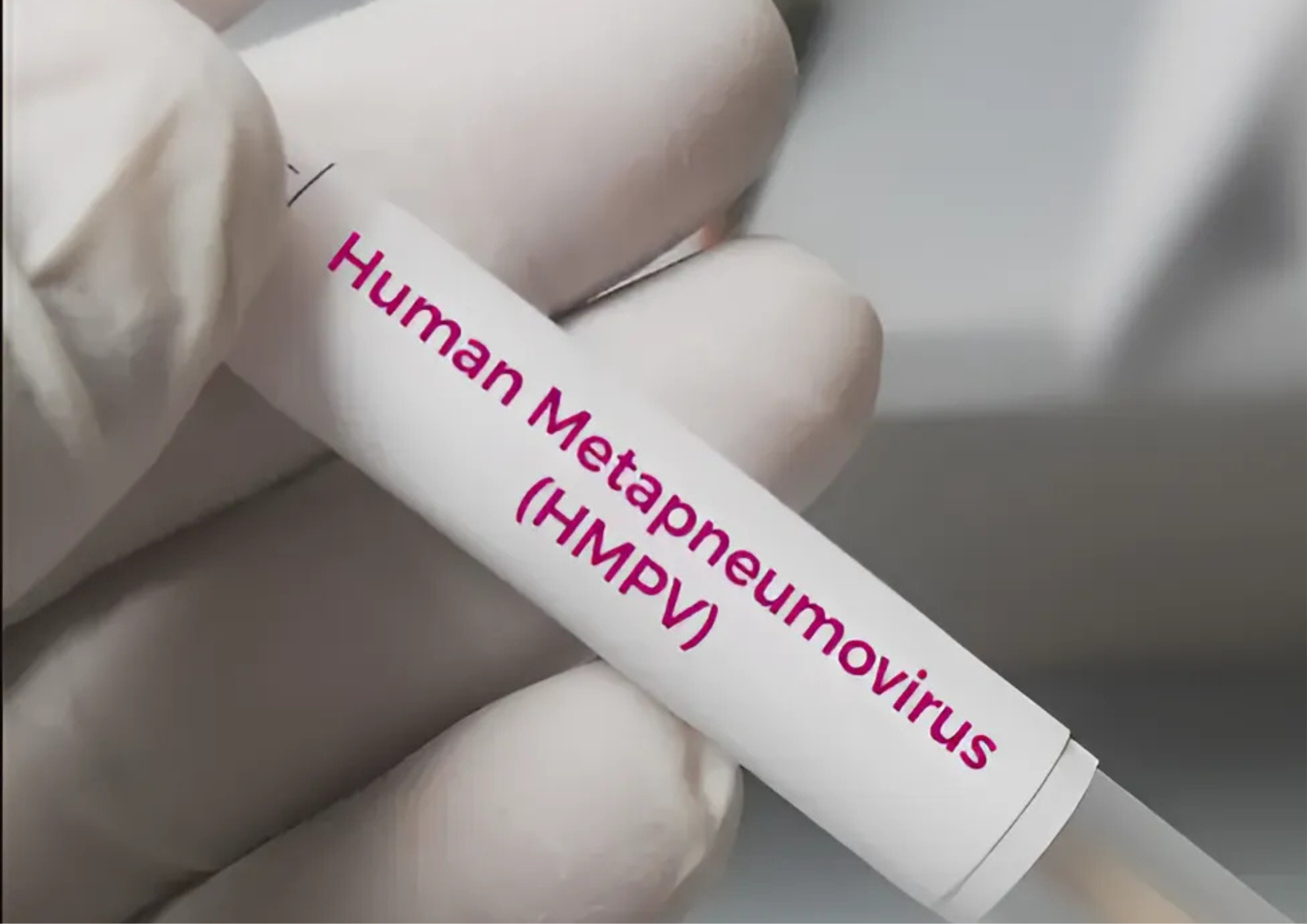 Human Metapneumovirus (HMPV): What You Need To Know - Inspiration Republic